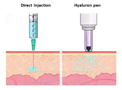 Everything You Need To Know About The Kabelline Serum - Upkeep Skin